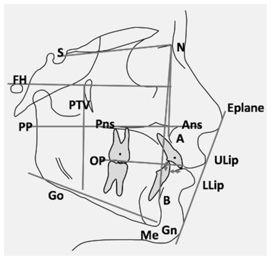 Skeletal, Dental and Soft Tissue Cephalometric Changes after ...
