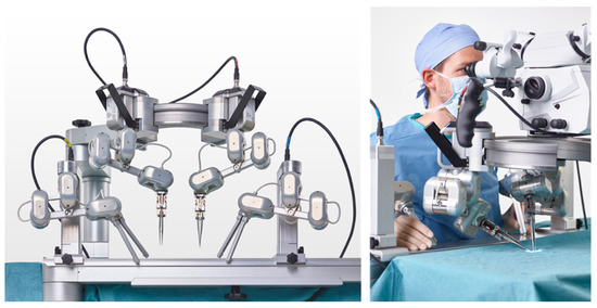 Robotic-Assisted Microsurgery and Its Future in Plastic Surgery