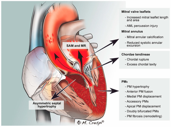 Review of Contemporary Invasive Treatment Approaches and Critical ...