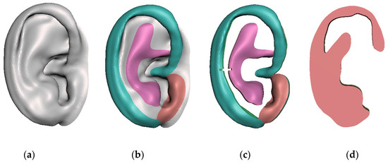 Microtia Ear Reconstruction with Patient-Specific 3D Models—A ...