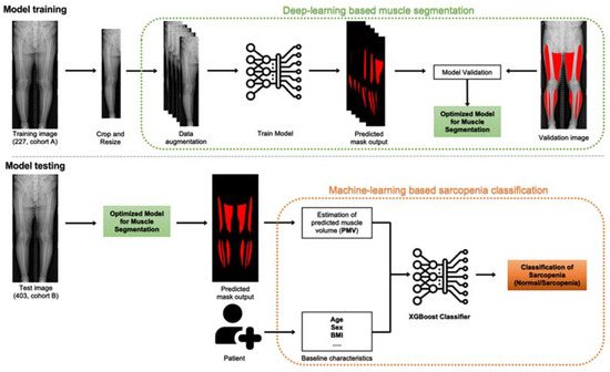 Deep Learning-Based Muscle Segmentation and Quantification of Full-Leg ...