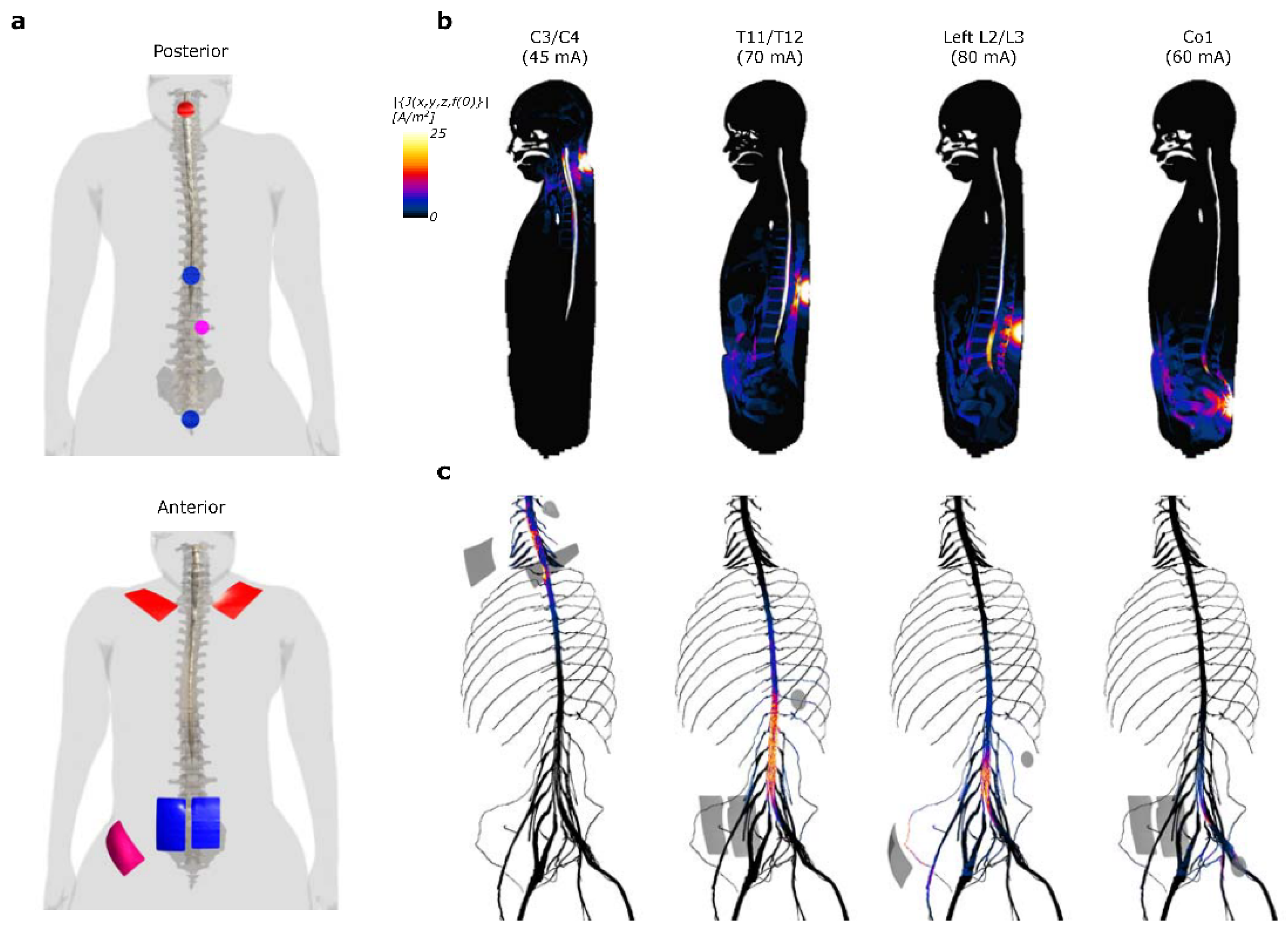 Novel Noninvasive Spinal Neuromodulation Strategy Facilitates Recovery ...