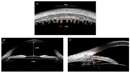 Characteristics of the Ciliary Body in Healthy Chinese Subjects ...