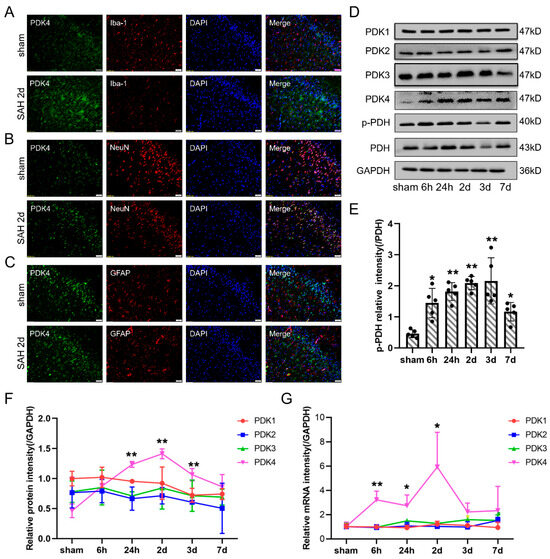 JCM | Free Full-Text | High Expression of PDK4 Could Play a Potentially ...