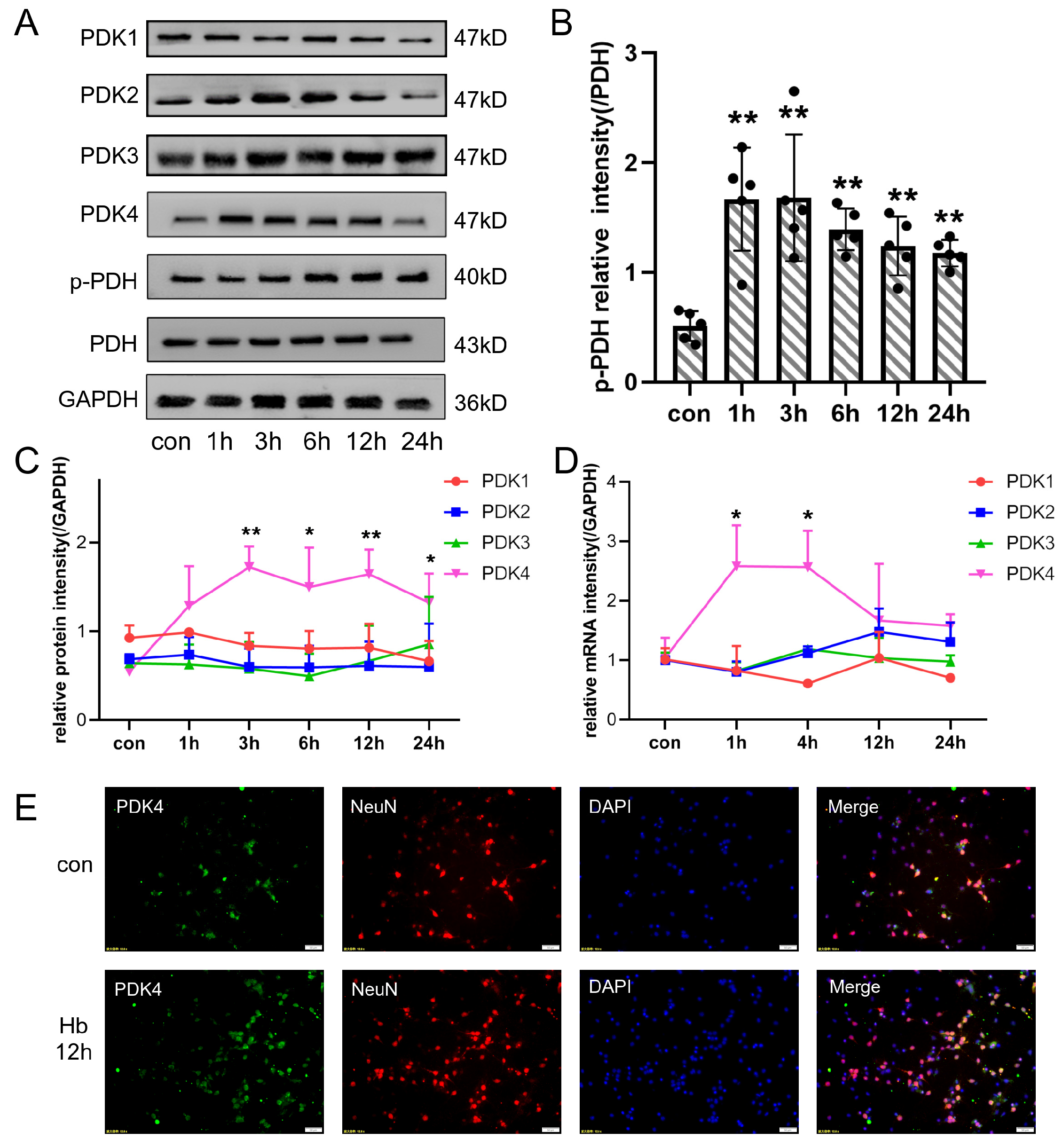 JCM | Free Full-Text | High Expression of PDK4 Could Play a Potentially ...