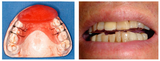 Diagnosis of Craniofacial Changes: Conventional Approaches and Novel ...