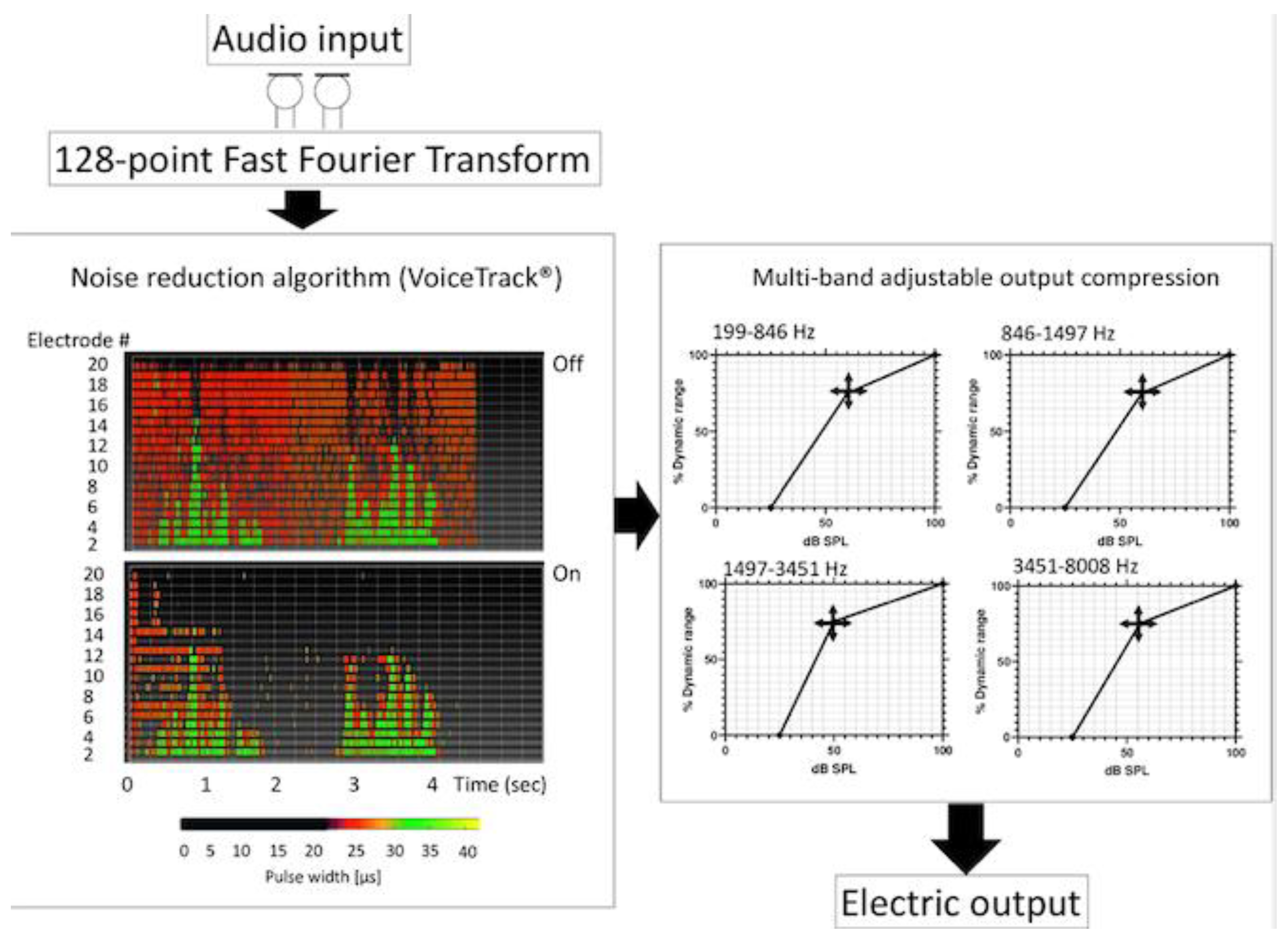 Effect of Sound Coding Strategies on Music Perception with a Cochlear Implant