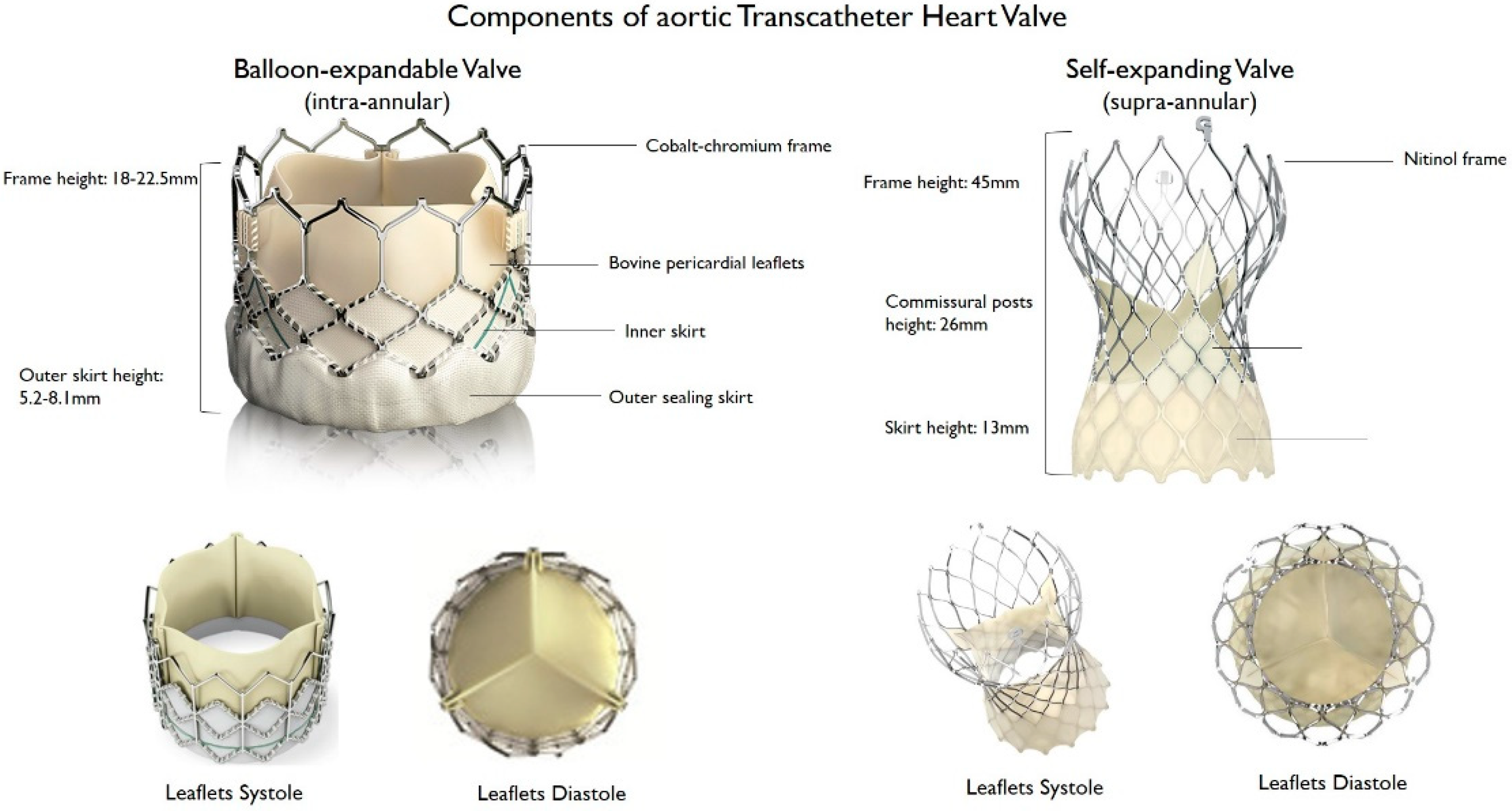 Heart Valve Implant Heart Valve Implant