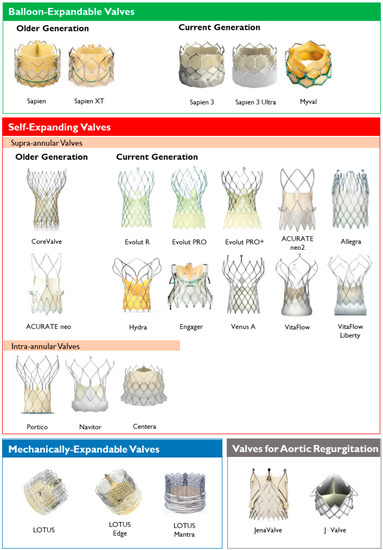 Evolving Devices and Material in Transcatheter Aortic Valve Replacement ...