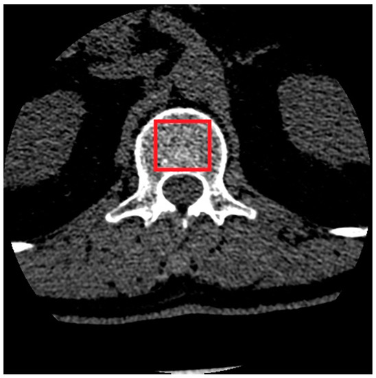 Comparison of the Classification Results Accuracy for CT Soft Tissue ...