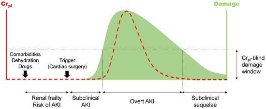 Diagnosis of Cardiac Surgery-Associated Acute Kidney Injury: State of ...