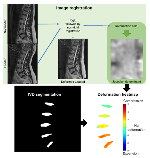 JCM | Free Full-Text | Non-Invasive Evaluation of Intradiscal ...