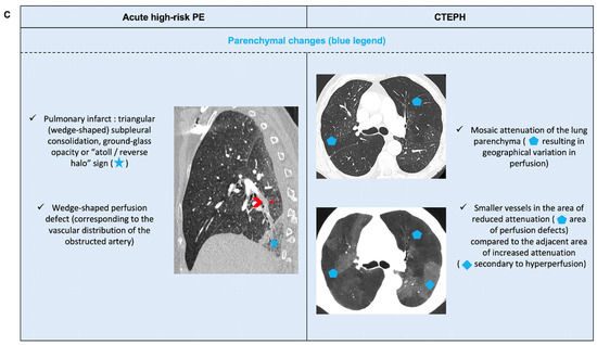 An Update on the Management of Acute High-Risk Pulmonary Embolism