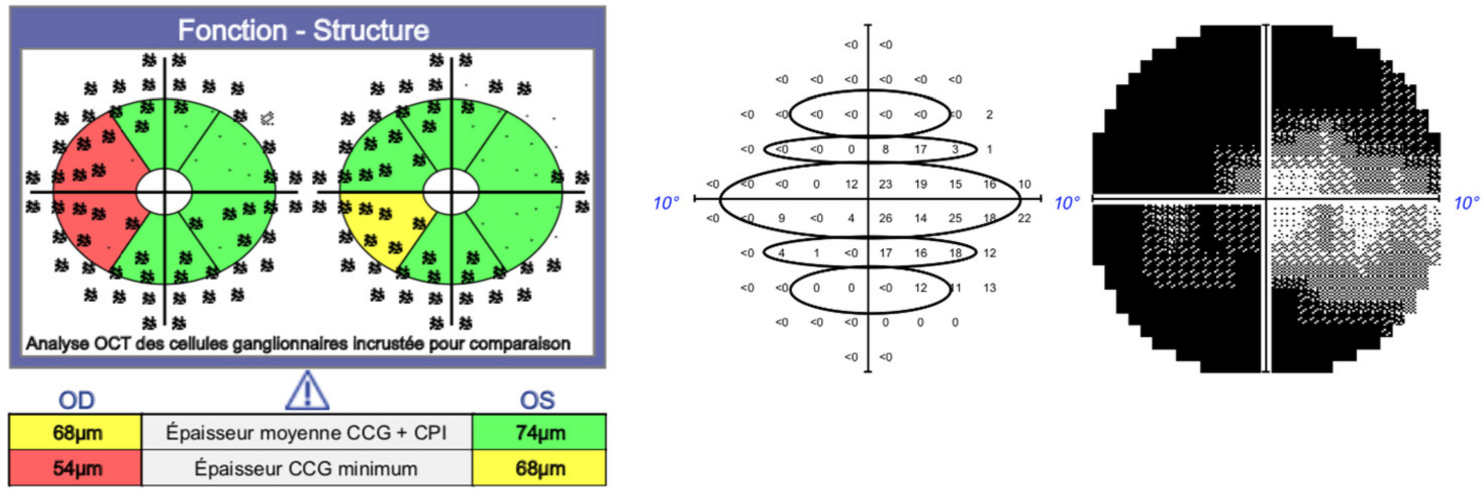 JCM | Free Full-Text | Evaluation of the Correlation between Regional ...