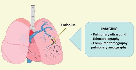 Jcm Free Full Text Pulmonary Embolism Presenting With Pulmonary