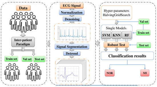 A Robustness Evaluation of Machine Learning Algorithms for ECG ...