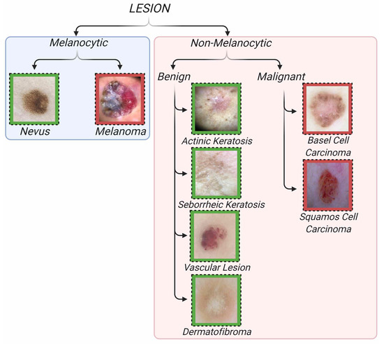 JCM | Free Full-Text | MobileSkin: Classification of Skin Lesion Images ...