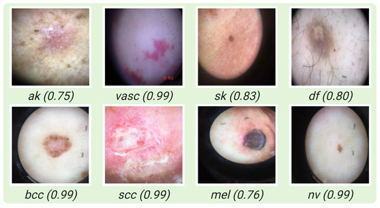 MobileSkin: Classification of Skin Lesion Images Acquired Using Mobile ...