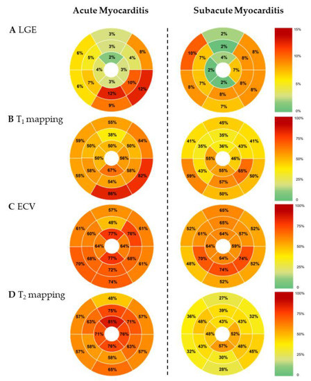 Comprehensive Cardiac Magnetic Resonance to Detect Subacute Myocarditis