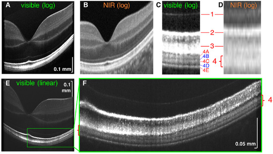 Advances in Optical Coherence Tomography Imaging Technology and ...