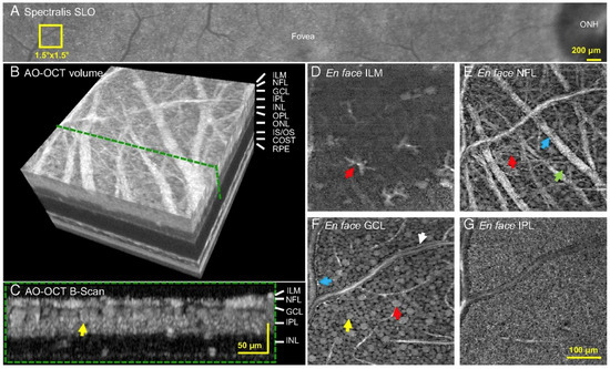 Advances in Optical Coherence Tomography Imaging Technology and ...