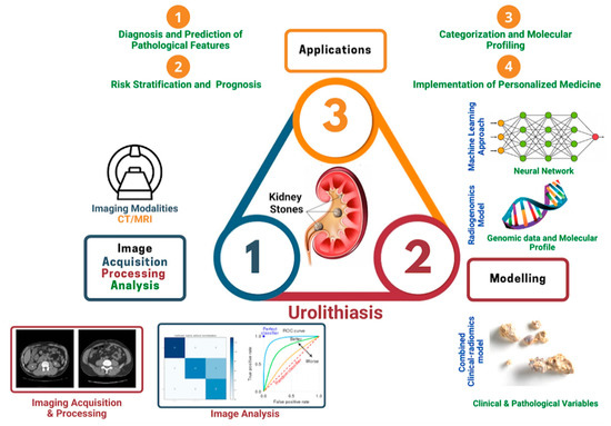 Urolithiasis