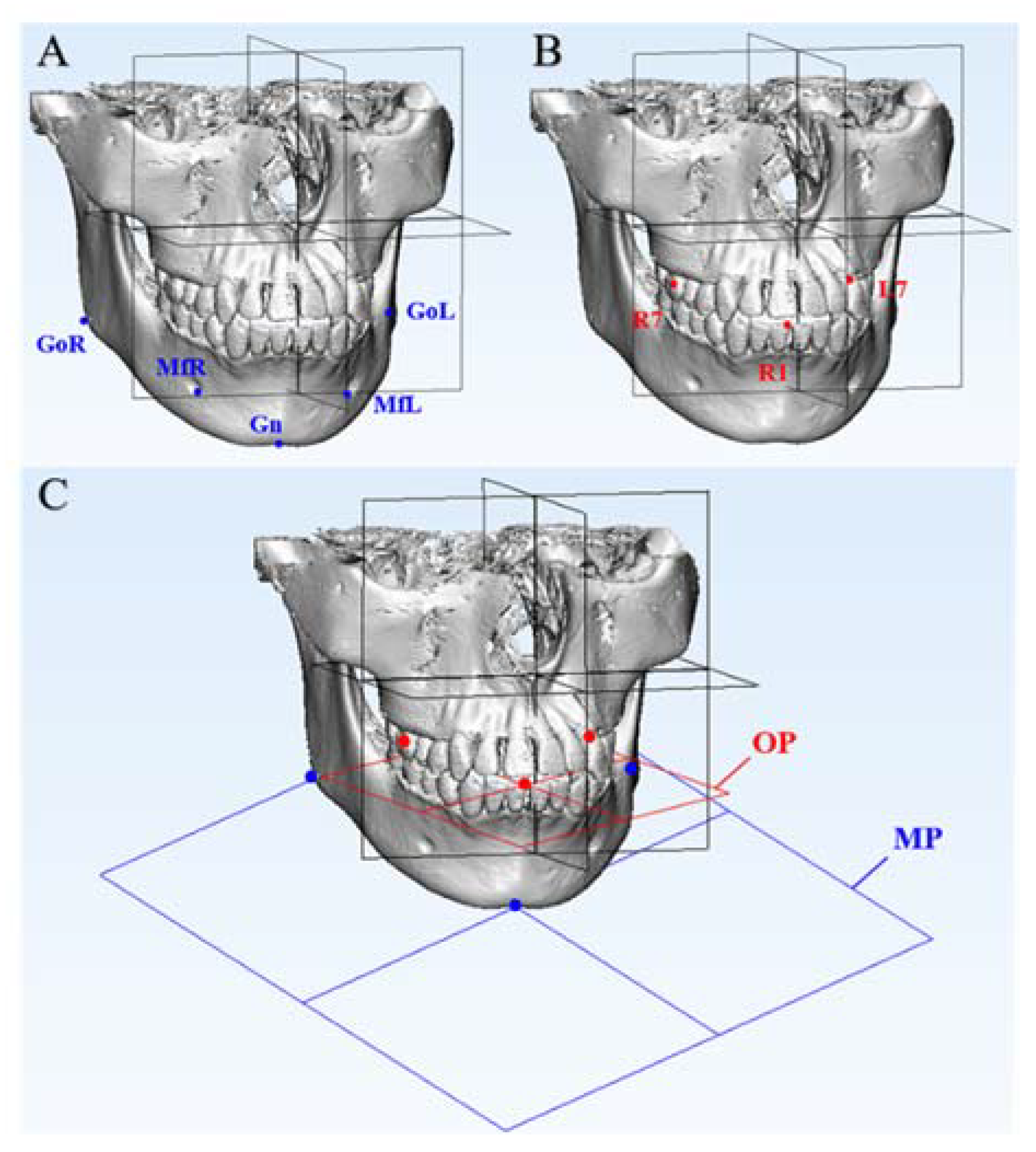 Jcm Free Full Text A Novel Method To Combine Maxilla Based