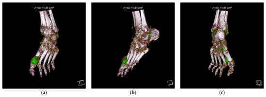 The Clinical Utility of Dual-Energy Computed Tomography in the ...