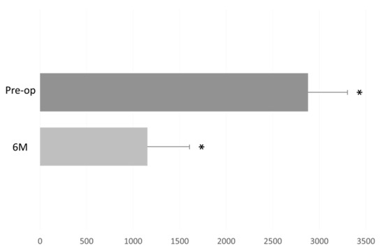 The Descemet Membrane Endothelial Keratoplasty (DMEK) “Wave Maneuver”