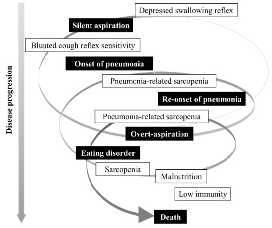 Aspiration Dysphagia