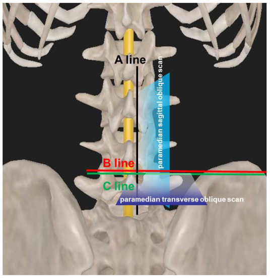 Dual- vs. Single-Plane Ultrasonic Scan-Assisted Positioning during ...