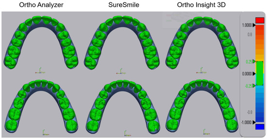 Comparing 3D Tooth Movement When Implementing the Same Virtual Setup on ...