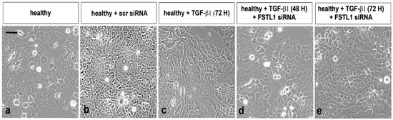 JCM | Free Full-Text | The Expression of Follistatin-like 1 Protein Is ...