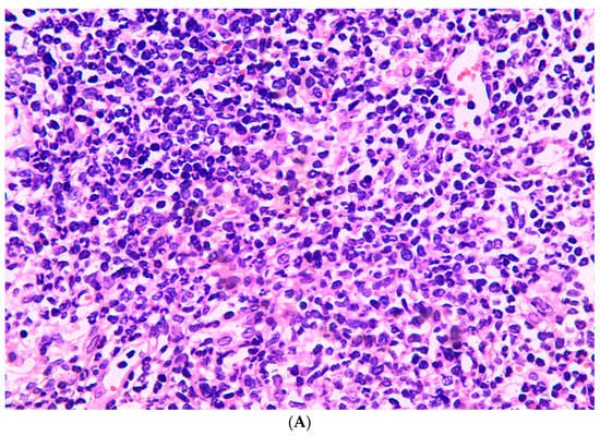 Experimental Phaeohyphomycosis of Curvularia lunata