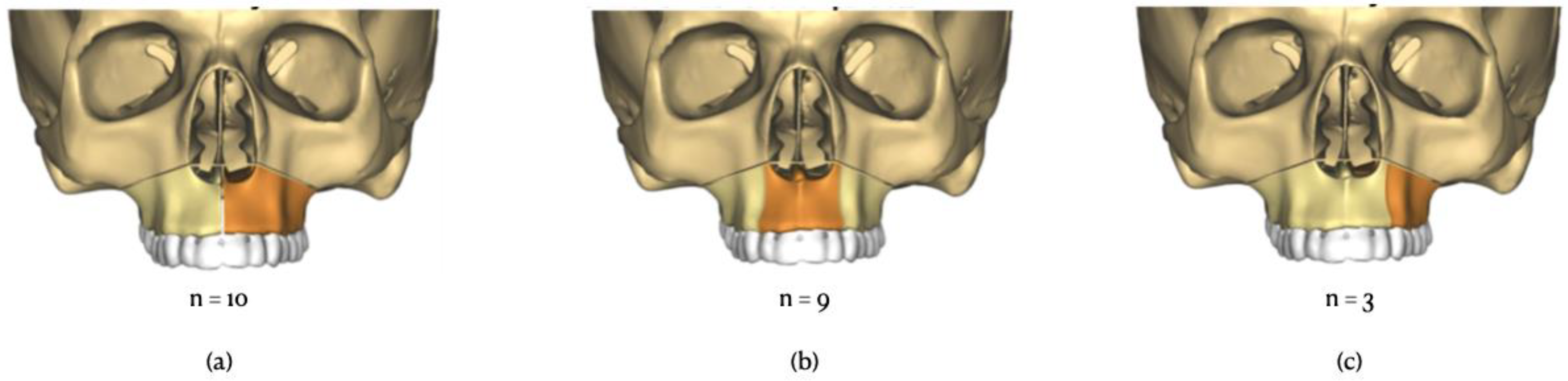 JCM | Free Full-Text | Accuracy of Segmented Le Fort I Osteotomy with ...