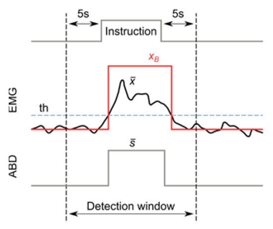 Correlation between a Force-Sensing Oral Appliance and Electromyography ...