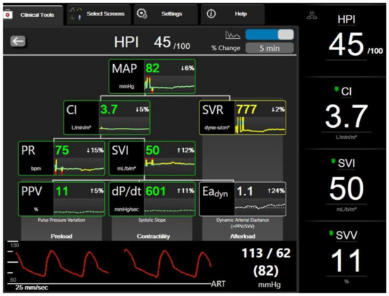 Prediction and Prevention of Intraoperative Hypotension with the ...