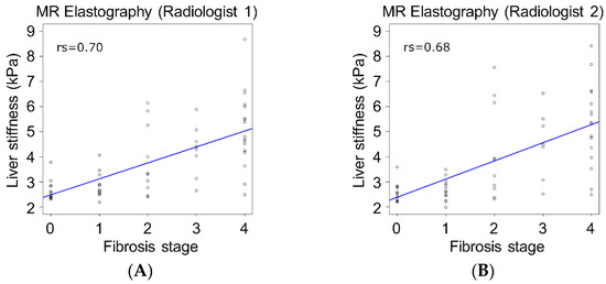 Noninvasive Liver Fibrosis Staging: Comparison of MR Elastography with ...