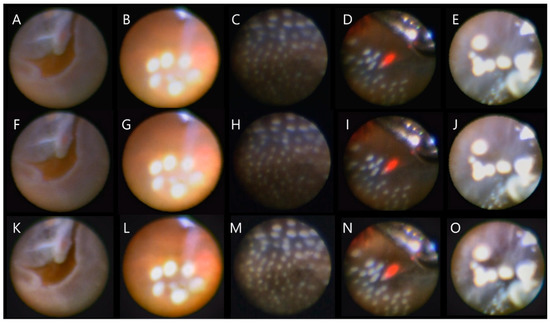 Effects of Image Processing Using Honeycomb-Removal and Image-Sharpening Algorithms on ...