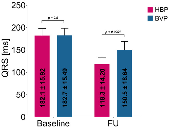 The Effects of His Bundle Pacing Compared to Classic Resynchronization ...