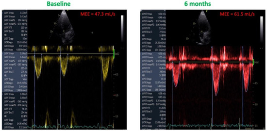 The Effects of Device-Based Cardiac Contractility Modulation Therapy on ...