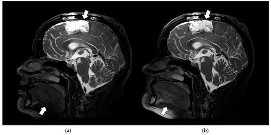 Evaluation of a New, Highly Flexible Radiofrequency Coil for MR ...