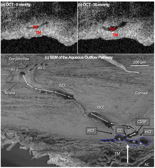 Viscoelastic Biomechanical Properties of the Conventional Aqueous ...