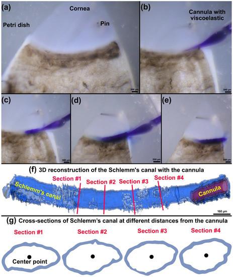 Viscoelastic Biomechanical Properties of the Conventional Aqueous ...