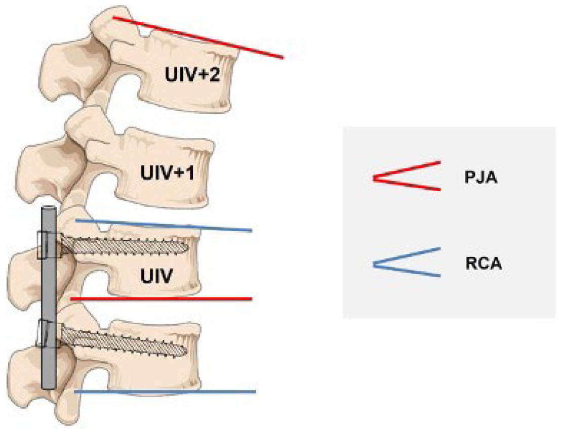 Jcm Free Full Text Risk Factors Of Proximal Junctional Kyphosis In Adolescent Idiopathic
