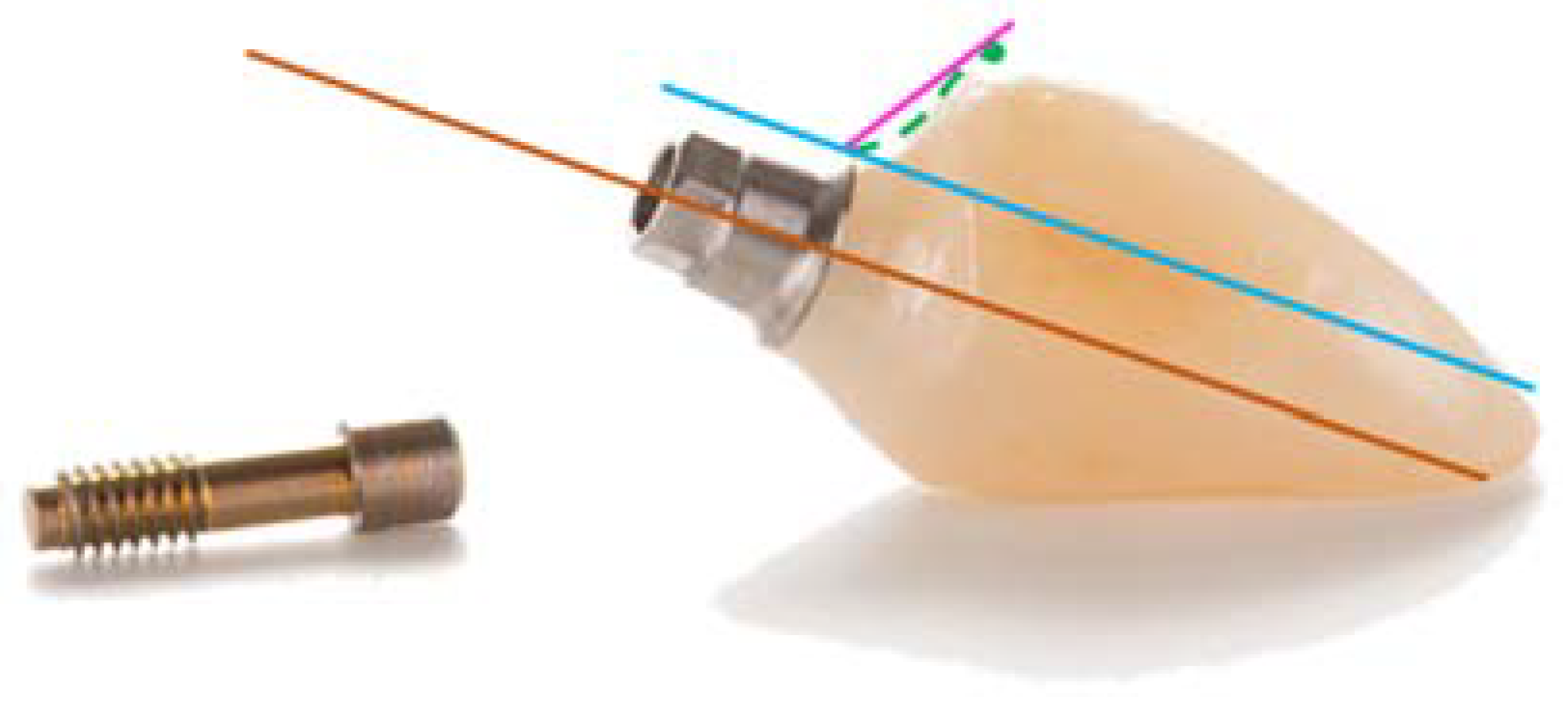 Association between Peri-Implant Soft Tissue Health and Different ...