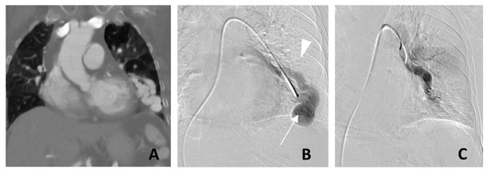 The Role of Interventional Radiology in the Diagnosis and Treatment of ...