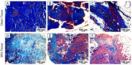 Increased Population of CD40+ Fibroblasts Is Associated with Impaired ...