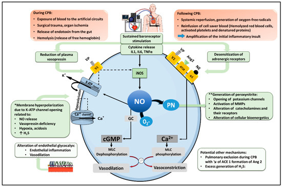 Vasoplegic Syndrome after Cardiopulmonary Bypass in Cardiovascular ...