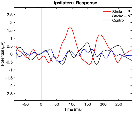 Cortical Reorganization of Early Somatosensory Processing in ...
